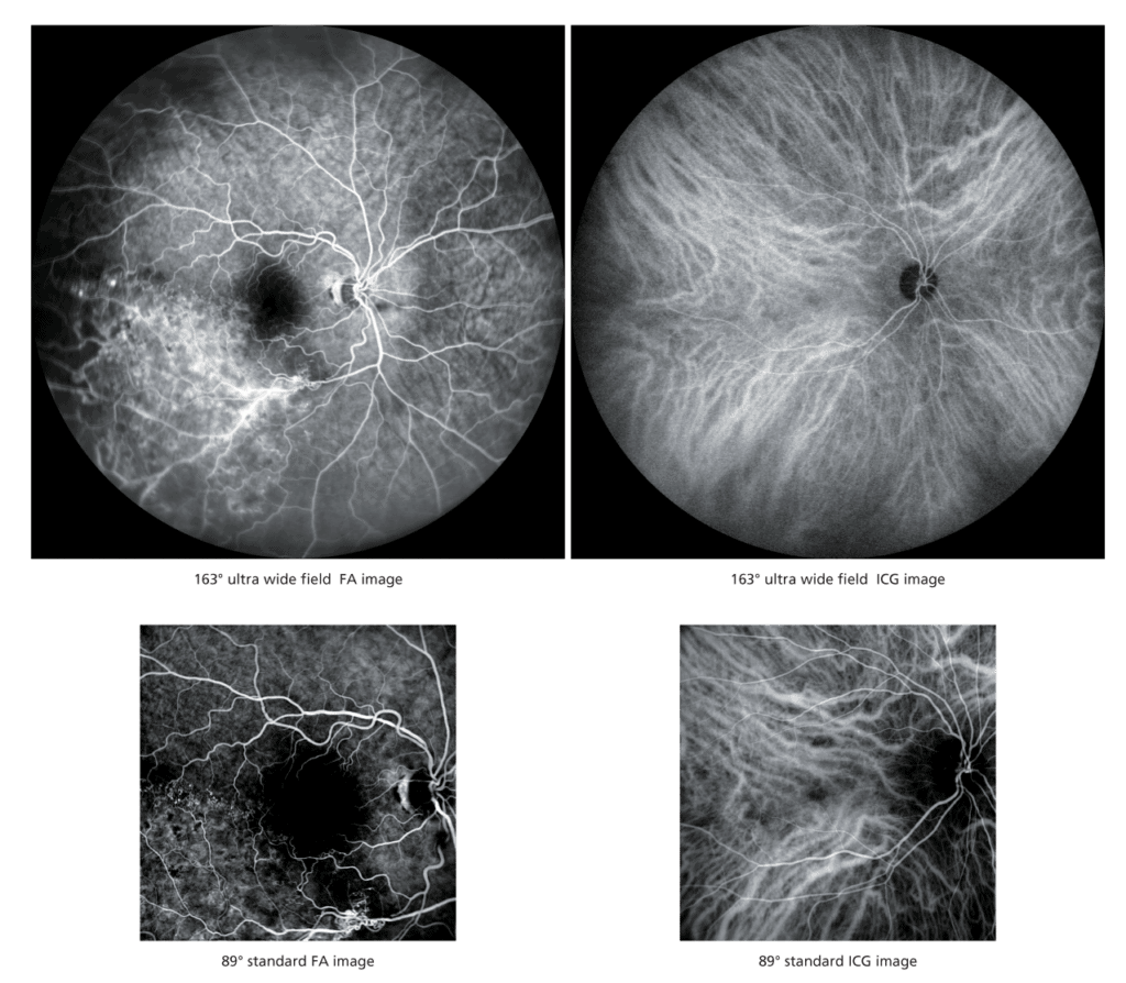 Mirante | Technology | NIDEK USA